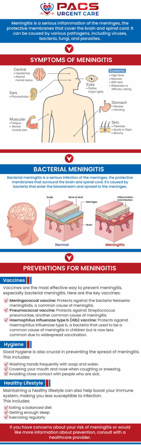 Meningitis Treatment in Alexandria and Ruther Glen, VA